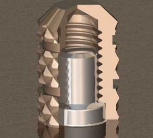 HiMould® | Tappex Threaded Inserts